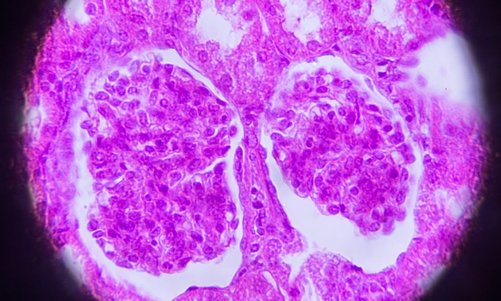 Surgical Pathology Testing Lab | TOPLAB® - NY, NJ & Nationwide