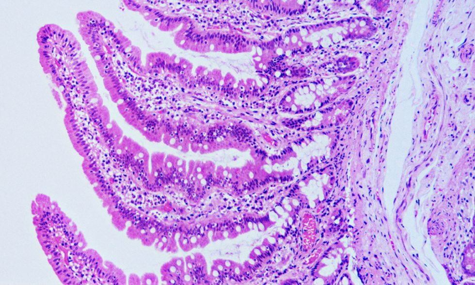 Surgical Pathology Testing Lab | TOPLAB® - NY, NJ & Nationwide